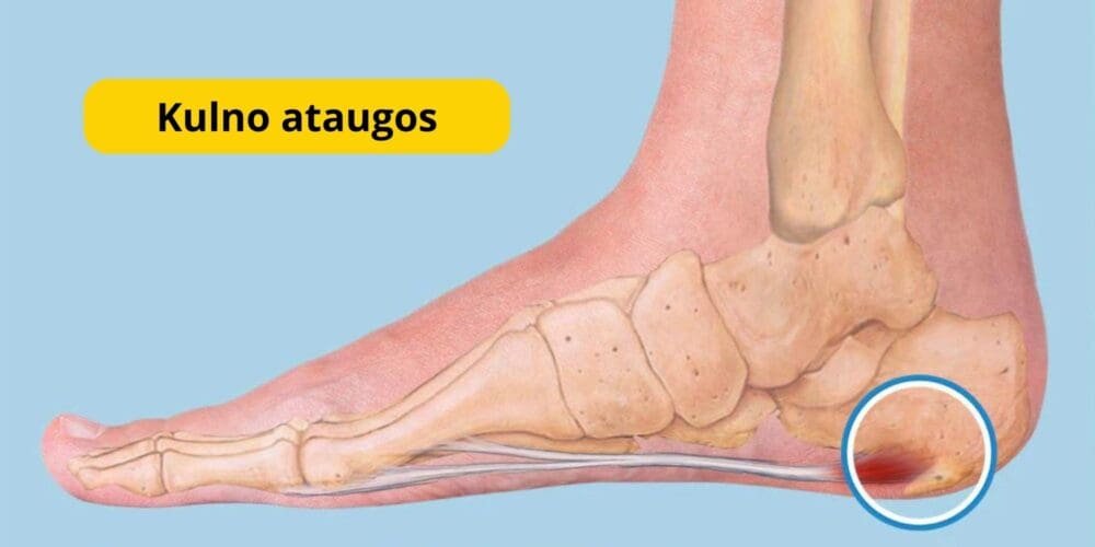 Kulno skausmas: priežastys ir sprendimo būdai - Mano Pėda